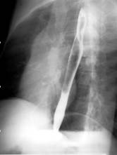 Anatomia radiologica a cordului